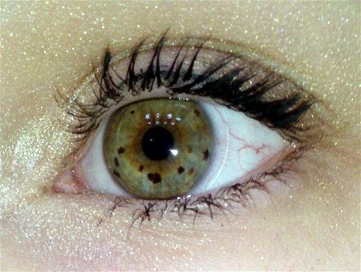 Ai puncte negre pe iris? Iată ce spun petele de pe ochi despre ...